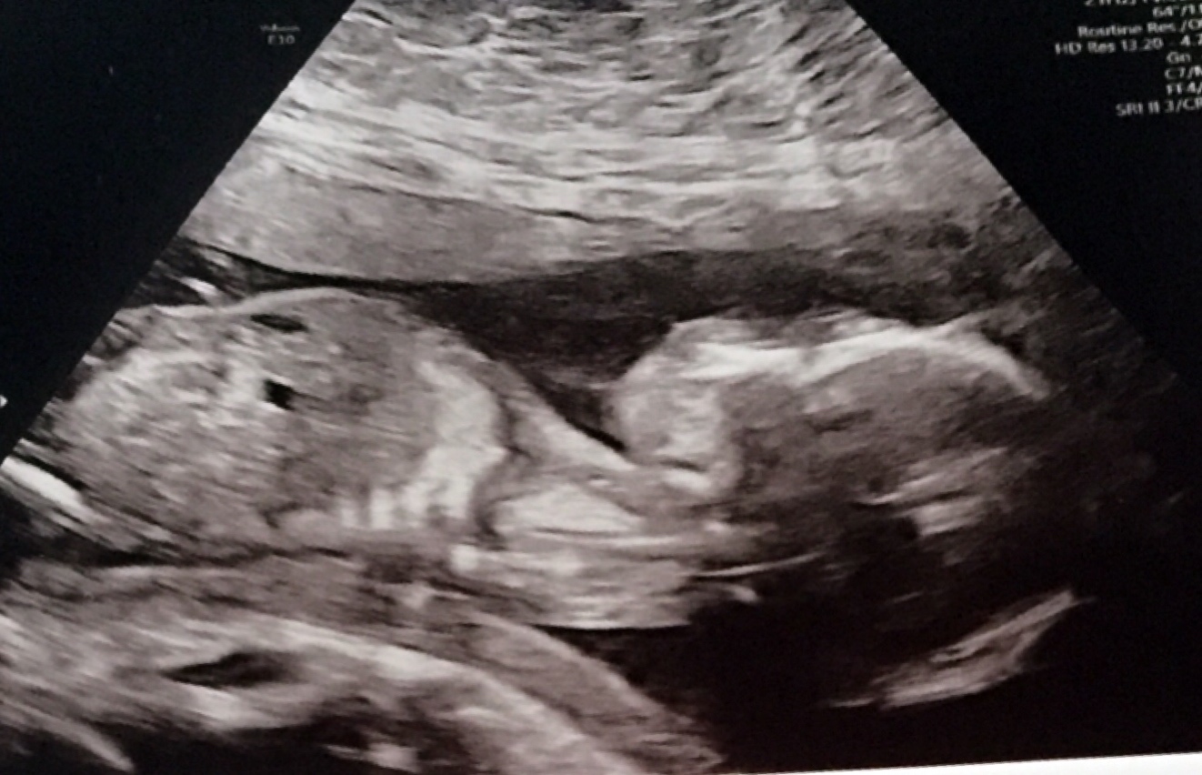 Is this your first baby? – FOR FRANCESCA